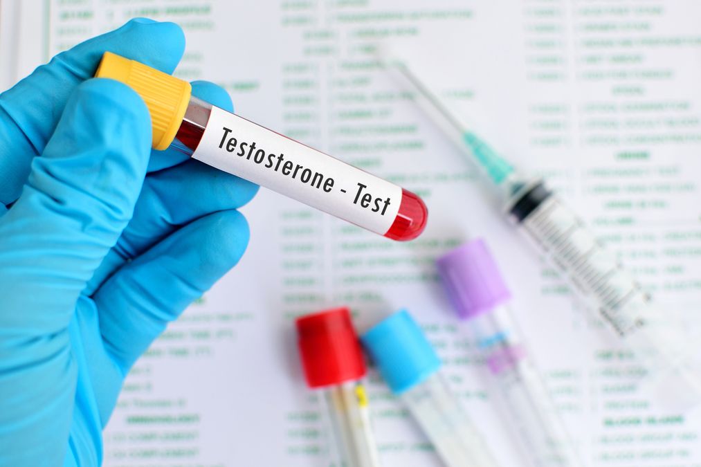 Testosteron | männliches Sexualhormon | Androgen